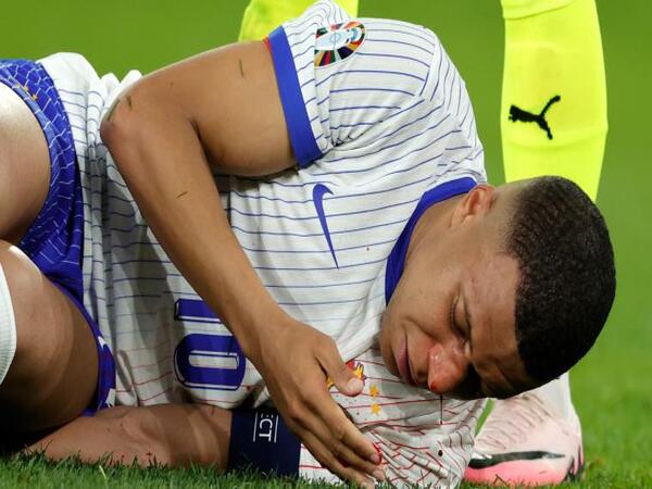 Patah Tulang Hidung, Mbappe Tak Bisa Main Lagi di EURO 2024? | Liga Olahraga